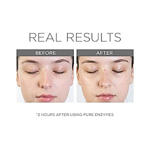 COSMEDIX Pure Enzymes Cranberry Exfoliating Mask, Gently Exfoliates Dry Skin, Helps Smooth Skin Texture, L-Lactic Acid & Cranberry Enzymes, Cruelty Free