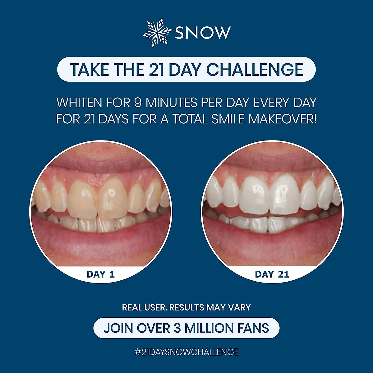 SNOW Diamond Wired Whitening Kit - Sensitive Teeth Whitening Kit - Whitens & Repairs Teeth 6 Months of Treatment Gentle & Enamel Safe Blue