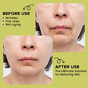 Swiss Botany Swiss Apple Stem Cell Serum for Face – Apple Stem Cell 3000 | Plant Stem Cell to Reduce All signs of Aging, Wrinkles, Discoloration, Restore Elasticity and Youthful Appearance, 1Fl Oz