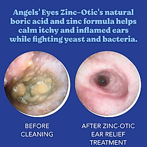 ANGELS’ EYES Zinc-Otic Ear Relief Treatment for Dogs and Cats Soothe Ear Infections Calm Itchy Inflamed Ears Natural BA and Zinc Formula 1 Ounce