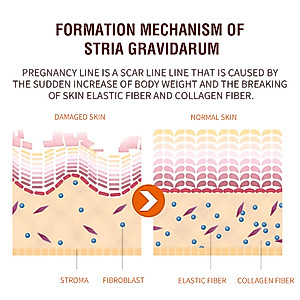 Maternity Stretch Marks Repair Cream Skin Care Scar and Pregnancy Wrinkles Removing Cream During Pregnancy, Skincare Gifts for Women Moms, 50ml