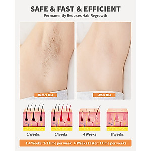 GERCY Hair Removal Device, Laser Hair Removal for Women Permanent with 9 Energy Levels, 2 Flash Modes and 999,999 Flashes, IPL Hair Removal for Face, Arms, Armpits, Bikini Line, Legs and Whole Body