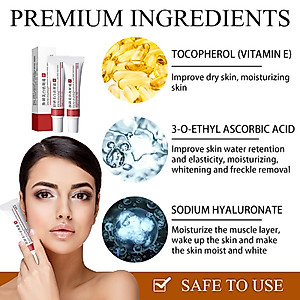 2 Pcs Whitening Freckle Cream, Acne Scar Removal Treatment Cream, Pigmentation Removal Cream for Face, Moisturizing Removes Facial Melasma Dark Spots Wrinkles Blemishes (whitening freckle cream)