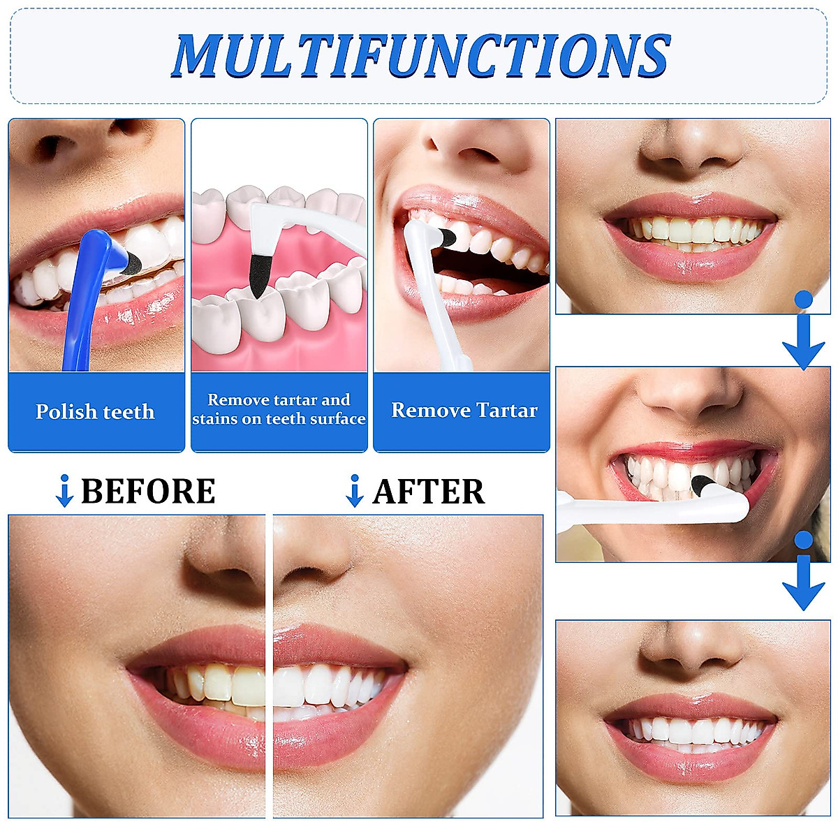 8 Pieces Tooth Stain Eraser Tooth Stain Removers Tartar Eraser Polisher Dental Plaque Tool Teeth Cleaning Kit for Teeth Whitening Polishing