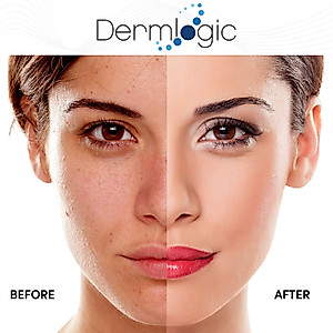 Glycolic Cream 15% - Natural Anti Aging Exfoliator to Smooth Away Fine Lines & Wrinkles & Improve a Dull Looking Complexion. Includes A.H.A & Green Tea Moisturizer for Face & Body.