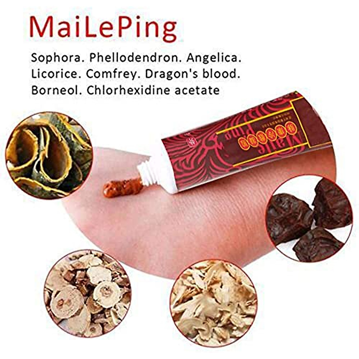 LBXB 1/2/3pcs Advanced Varicose Remission Cream Ointment, Spider Leg Repair Cream, Varicose Veins Cream, Varicose Vein & Soothing Leg Chinese Treatment Cream Miracle Relief Phlebitis Angiitis (3pcs)