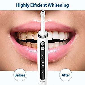 Tooth Polisher, Smile-Aid Multifunctional Replacement Head Teeth Whitening Kit, Better Whitening Effect Than Electric Toothbrush, USB Charging, Waterproof