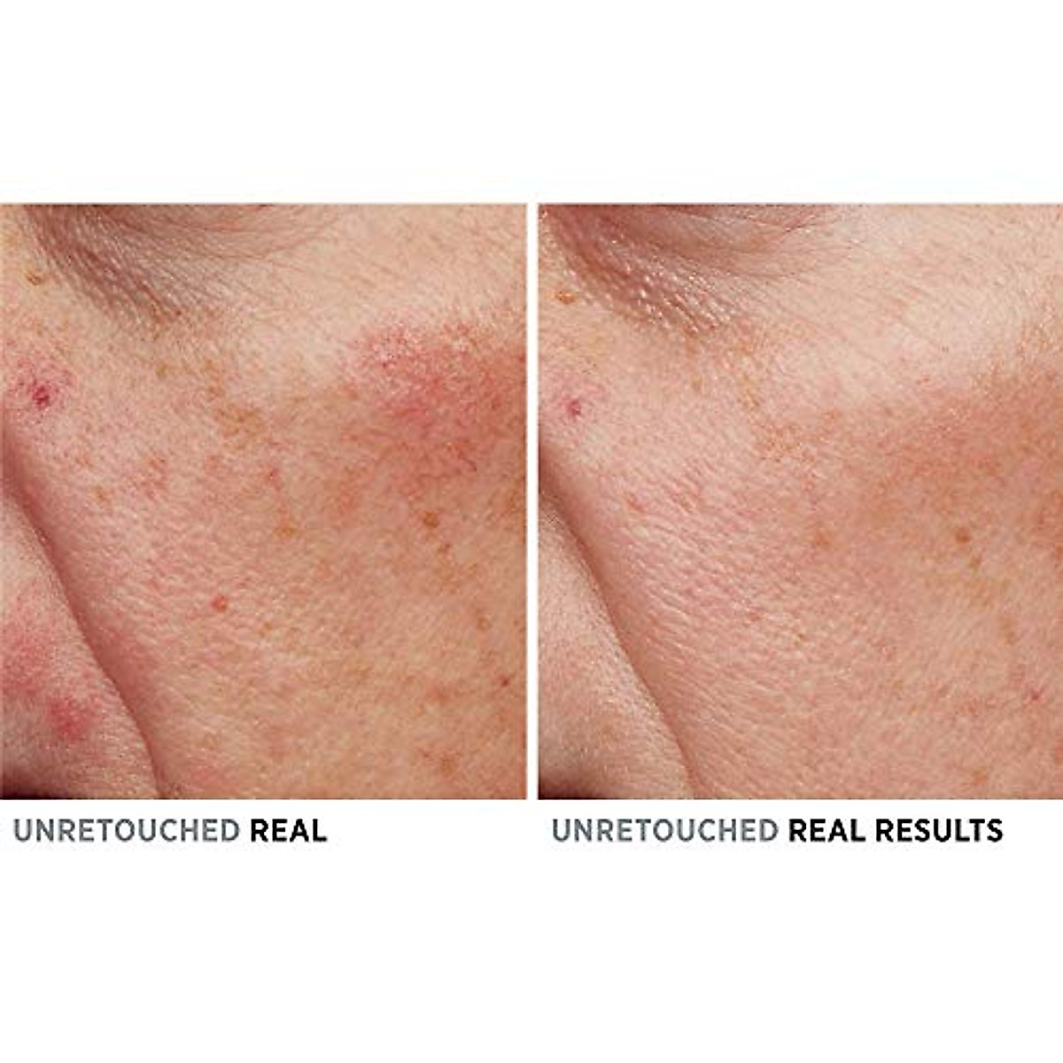 it COSMETICS Bye Bye Redness - Sensitive Skin Moisturizer - Reduces Facial Redness - With Colloidal Oatmeal, Aloe & Cucumber - 2.0 oz