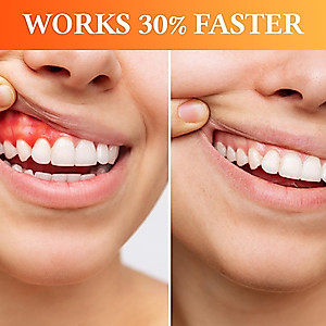 The Goodbye Company Gum Disease Treatment - 100% Pure Neem & Clove Oil - Natural Gingivitis Remedy - Non-Toxic, BPA-Free Oral Care - Fast-Acting Gum Healer (30ml)