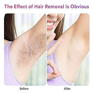 ONE BEAUTY IPL Hair Removal for Women and Men, Ice-Cooling, Ice Painless Laser Hair Removal, FDA Cleared, Permanent Hair Removal Device for Facial Whole Body, 999999 Flashes Hair Remover with 5 Modes