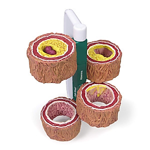 4-Piece Artery Model | Human Body Anatomy Replica of Artery w/Plaque Build Up for Doctors Office Educational Tool | GPI Anatomicals