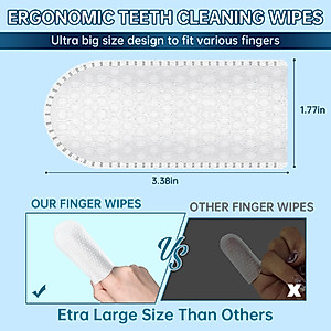 Woyamay Teeth Cleaning Wipes for Dogs & Cats, 120 Counts Dental Wipes for Reducing Plaque & Tartar for Cats and Dogs, Disposable Gentle Breath Freshener Dental and Gum Care Finger Pet Wipes