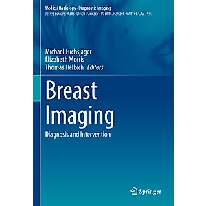 Breast Imaging: Diagnosis and Intervention (Medical Radiology)