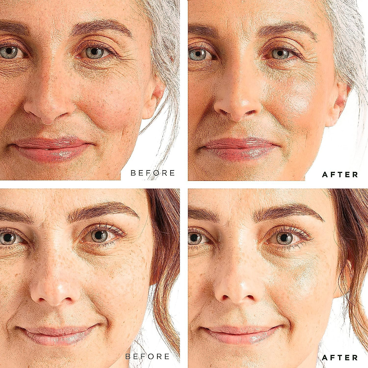 Tree of Life Beauty Facial Skin Care Set, Brightening, Firming, Hydrating, Dry Face, Dermatologist Tested - Retinol Serum and Hydrating Hyaluronic Acid - Skin Care Kit, 2 count of 1 Fl Oz