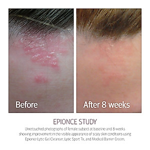 Epionce Medical Barrier Cream, 8 Fluid Ounce