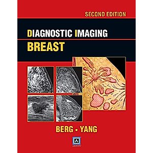Diagnostic Imaging: Breast