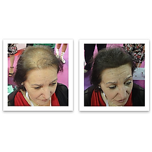 Caboki Hair Loss Concealer, 90-day supply, Dark Brown