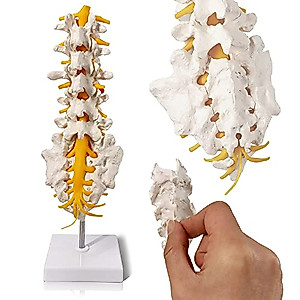 Evotech Lumbar Spine Anatomy Model with Sacrum and Spinal Nerves, Didactic Replica of Lumbrosacral Section with Nerves and A Herniated Disc at L4, Includes Base for Medical Teaching Display