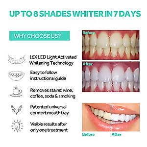 Teeth Whitening Accelerator Light, 16x More Powerful Blue LED Light, Mouth Tray Teeth Whitening Enhancer Light Trays Connected with iPhone/Micro-USB Android/USB for Home Use