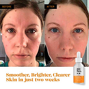 No B.S. (No Bad Stuff) Vitamin C + E Serum - Firming Face Serum for Anti-Aging, Smooths, Hydrates, Plumps Fine Lines & Reduces Dark Spots (1 fl oz)