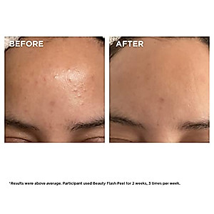 Clarins Beauty Flash Peel | 10-Minute At-Home Facial | Visibly Tightens Pores | Gently Eliminates Dead Skin Cells | Refines Skin Texture | Renews Radiance | Contains AHAs and BHAs | All Skin Types