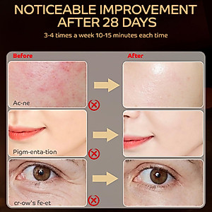 Hottoerak Red Light Therapy for Face, LED Red Light Therapy Mask 660nm & 850nm Wavelength for Home Use