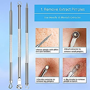 Best Blackhead Remover, Blackheads Blemish Removing, Acne Whitehead Removal Kit, Pimple Comedone Extractor Tool, Popper Pimples Treatment, with Tweezers, Risk Free for Face Forehead Nose