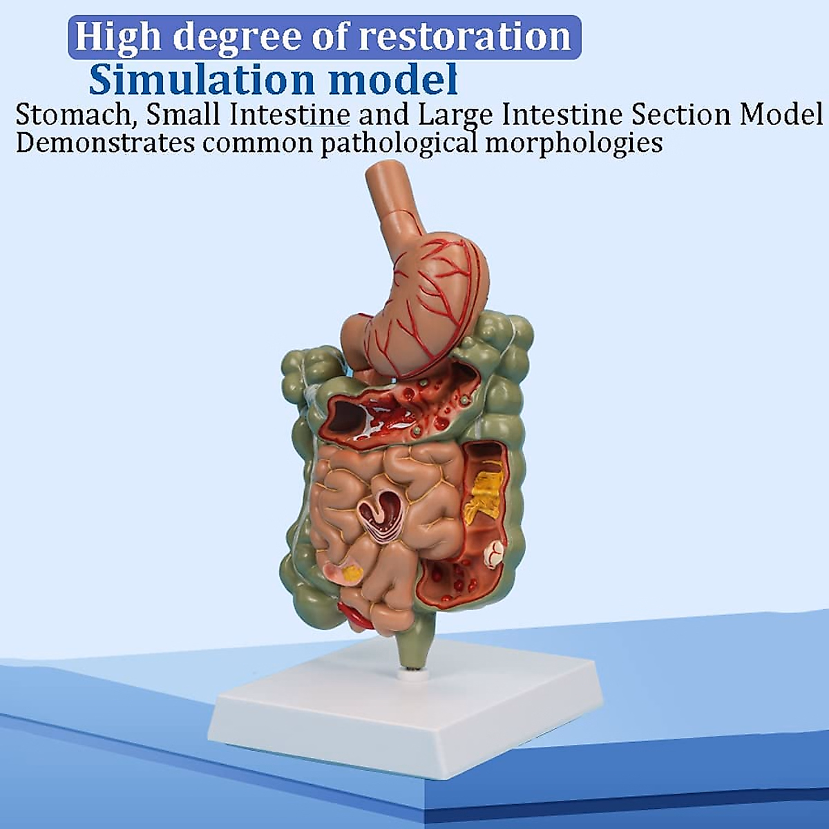 PAASHE Anatomy Model Human Stomach Anatomy Model Organs Model Human Body Model Stomach Section Large Small Intestine Medical Model Study Education