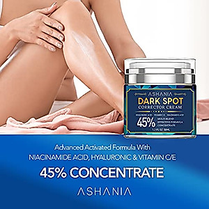 Ashania Dark Spot Remover for Face,Hyperpigmentation Treatment, Dark Spot Cream, Blemish spot treatment, Freckle Remover, Melasma treatment for face, Sun Spot Remover & Blemish Reducer, for All Skin Types