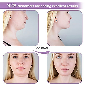 COSDAD Reusable Double Chin Reducer Chin Strap Face Slimming Strap Face Slimmer Shaper for Women,Breathable Comfortable V Line Lifting Mask,Innovative Lifting Technology,One Fits All,Purple