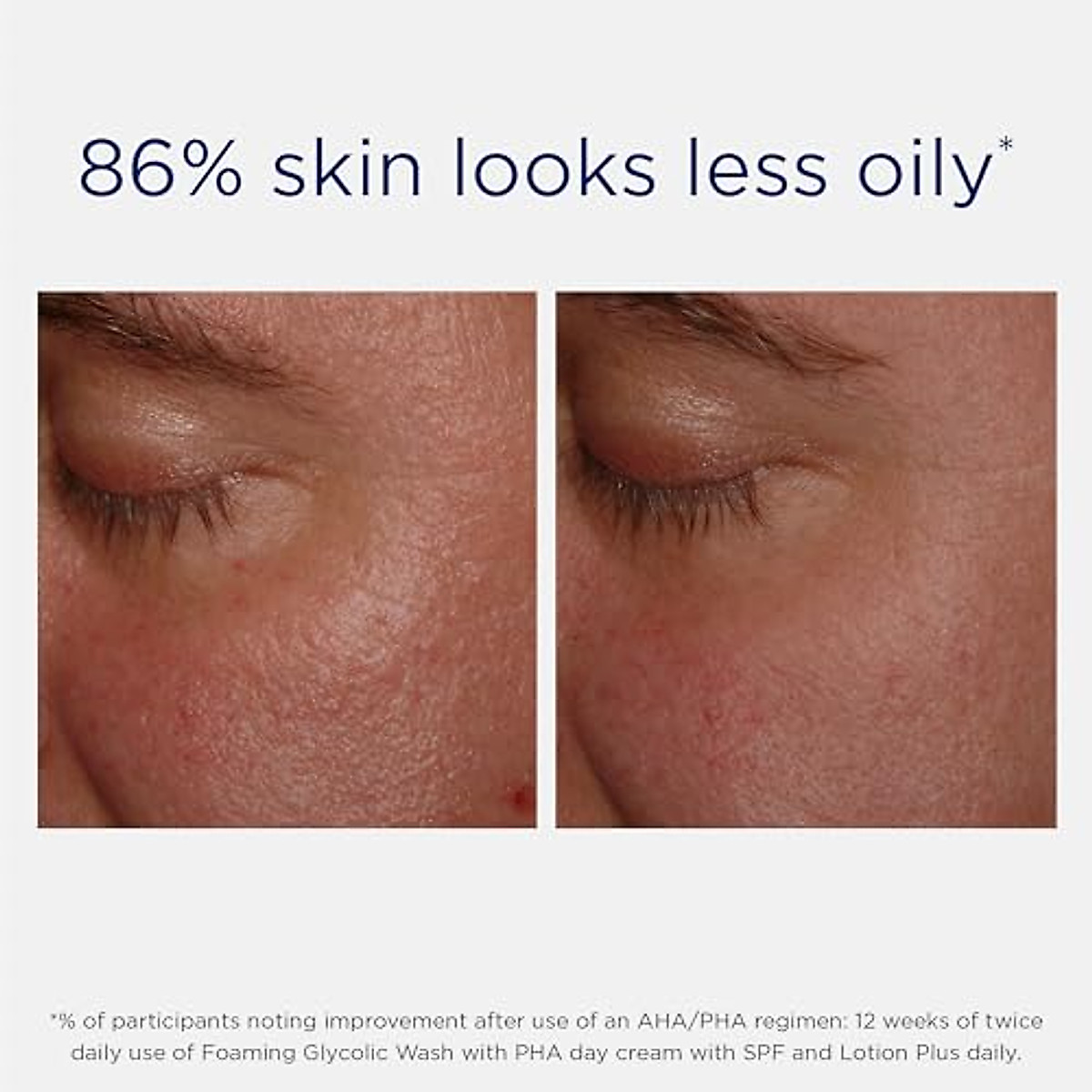 NEOSTRATA Foaming Glycolic Face Wash High Strength AHA Cleanser Soap-free, 4.2 fl. oz.