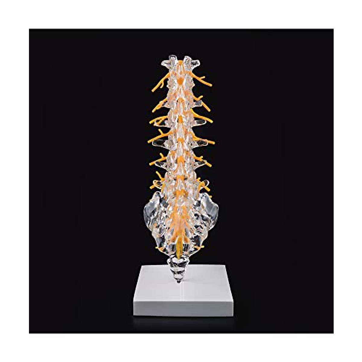 Ultrassist Human Lumbar Spine Model with Sacrum, Spinal Nerves and Herniation Disc, Includes Base for Display, Life Size Spine Model for Medical Education
