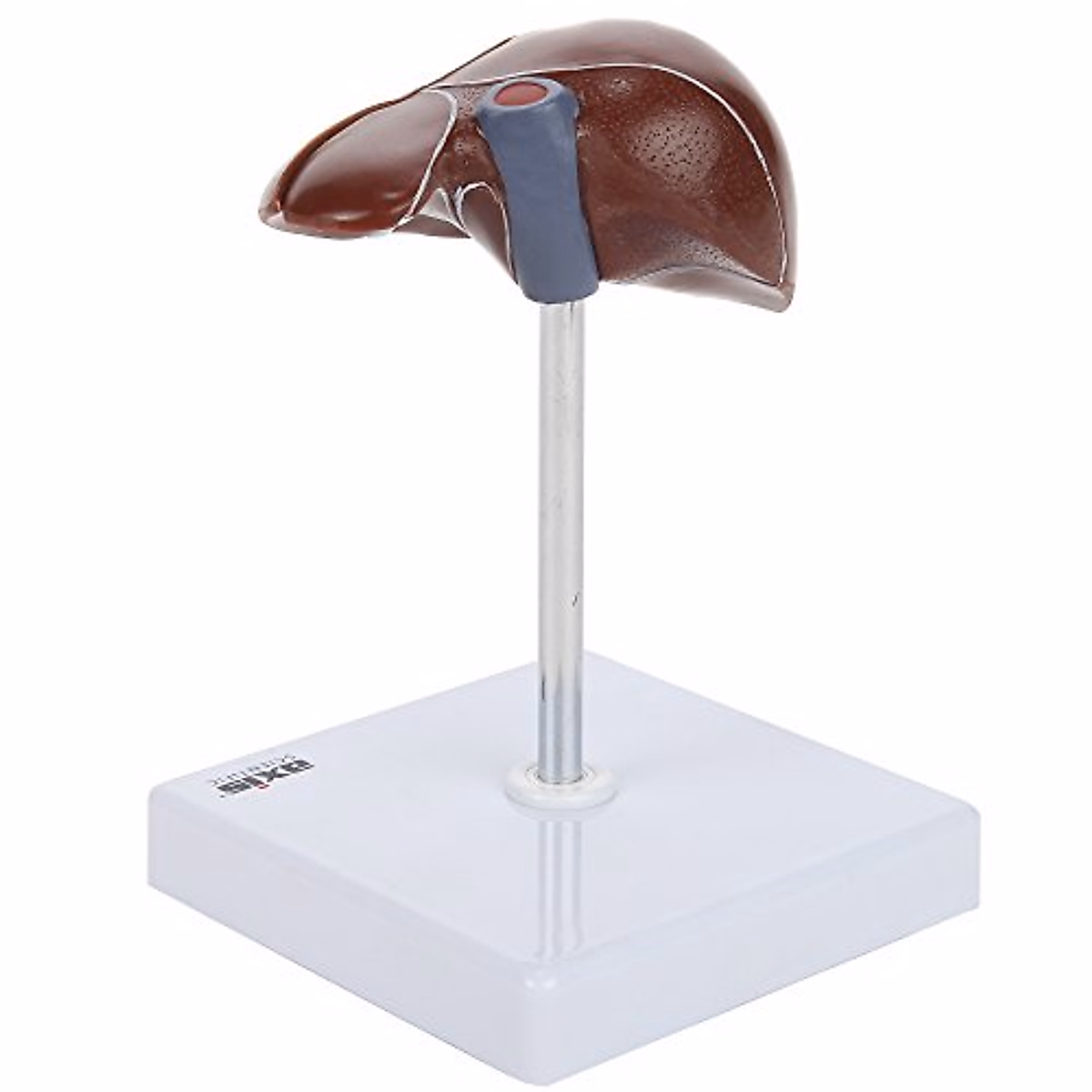 Axis Scientific Anatomy Model of Diseased Liver | Model is 1/3 Life-Size and Divides in 2 Parts | Shows 6 Liver Diseases and Abnormalities | Comes on a White Base