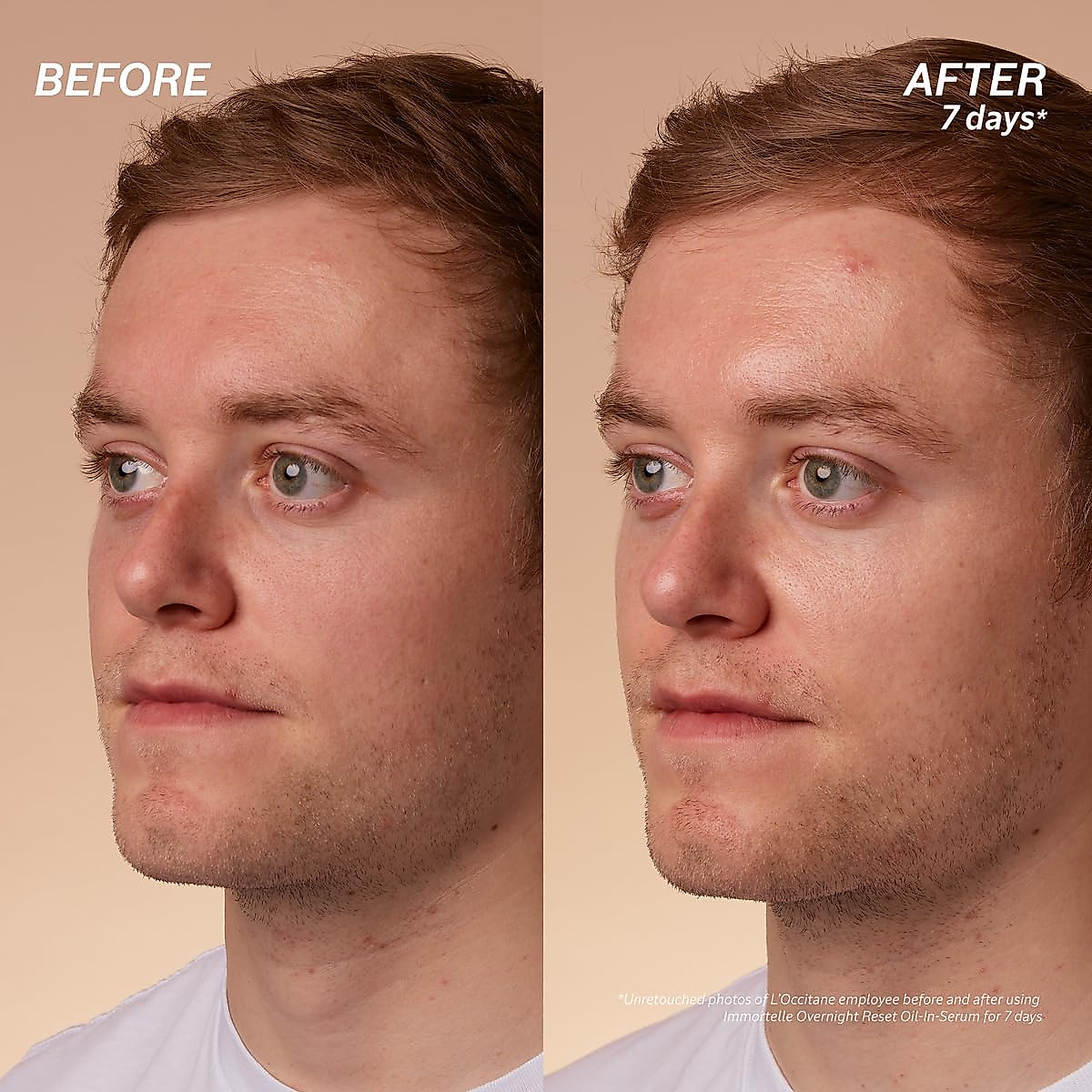 L'OCCITANE Immortelle Overnight Reset Oil-In-Serum: More Radiant Skin In 1 Night, Smooth Fine Lines, Revitalize Dull Skin, Award-Winner, With Immortelle Essential Oil, 1.6 Fl. Oz