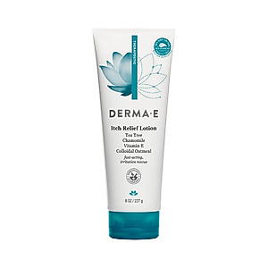 Derma E Itch Relief Lotion – Anti-Itch for Dry Skin – Soothing Itchy Skin Cream – Lightweight Body Lotion Calms and Moisturizes, 8 oz