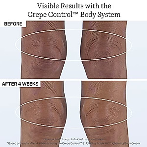 StriVectin Tighten & Lift Crepe Control Tightening Body Cream for Firmer, Brighter Arms & Legs, 6.7 Fl Oz