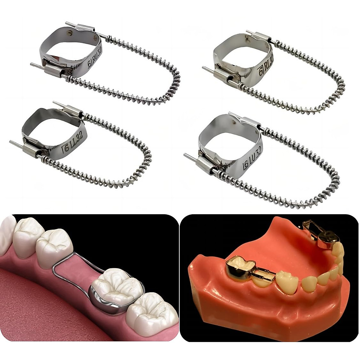 Space Maintainer For Children,10 Size/Box, 40pcs/Box, 4pcs/Size From Sino Dental Group (#6 Molar)