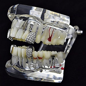 Single Cap Tooth Set CZ Cubic Zirconia Silver Tone 2 Top Teeth Plus Two Bottom Iced Canine Cap Grills