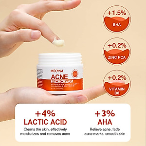 Acne Treatment for Face, Acne Cream Back Acne Treatment Cream for Teens & Adults Anti-acne Pimple Cream Butt Acne Clearing Cream, Acne Spot Treatment
