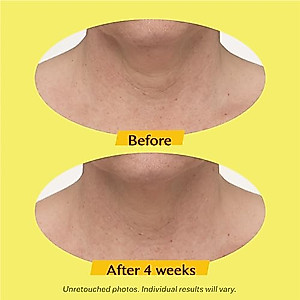 StriVectin TL Advanced Neck cream, 1.7 Fl Oz