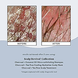 Briogeo Scalp Revival Scalp Soothing Solutions Set | Scalp Scrub Shampoo, Mask, Massager plus Mini Dry Scalp Treatment and Mini Dry Shampoo | Soothe a Dry, Flaky, Itchy or Oily Scalp | 14.3 Ounces