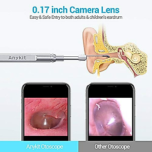 Anykit USB Otoscope Camera for iPhone & Android, 720P HD Visual Ear Camera with Lights, Ear Scope with Ear Wax Removal Tool & Storage Case, Ear Endoscope for Kids, Adults & Pets