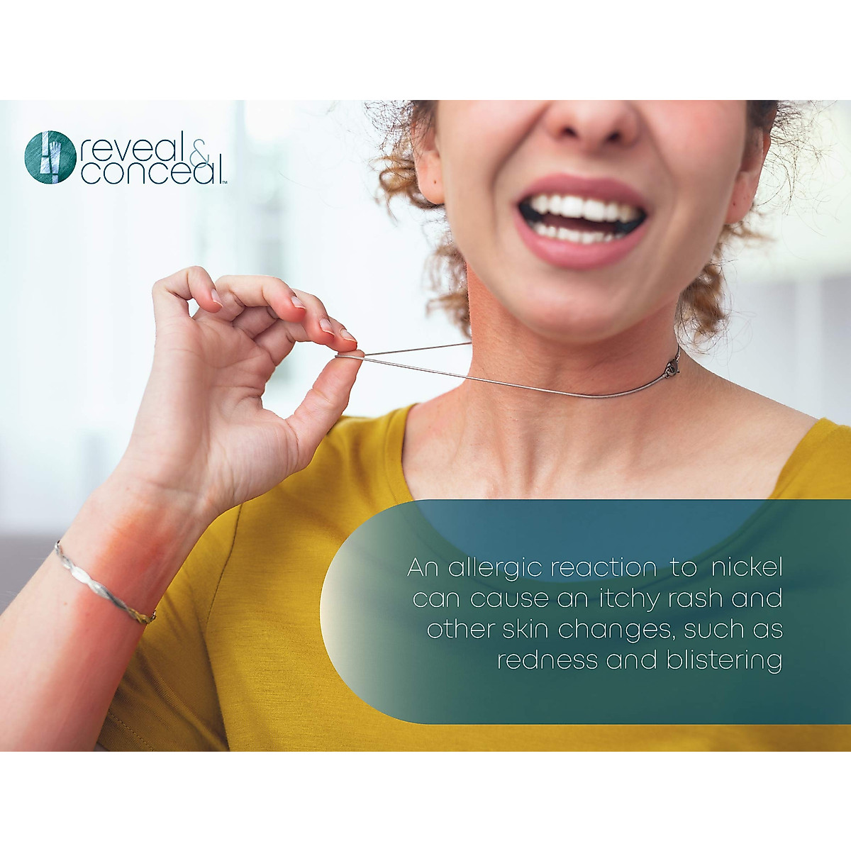 Reveal and Conceal Nickel Allergy Test Kit by Smart Practice - Detecting Nickel is a Snap - Test for Nickel in Your Jewelry and Prevent Skin Exposure With Liquid Clear Coat - Includes 10 Test Swabs