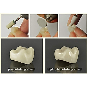 Supershu Polishing Kit For Composite