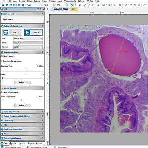 Vabiooth 5MP USB2.0 Digital Camera captures Still Images, Streams Live Videos, and is Compatible with WIN7/8/10/SP4/XP/VISTA, Mac, Linux