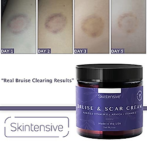 SKINTENSIVE Highest Purity Organic Arnica Plant-Based Bruise Cream for Thin Skin - Moisturizing, Anti-Aging, Healing, and Fading Scar Lotion, Vitamin K C and E, Skin Renewal
