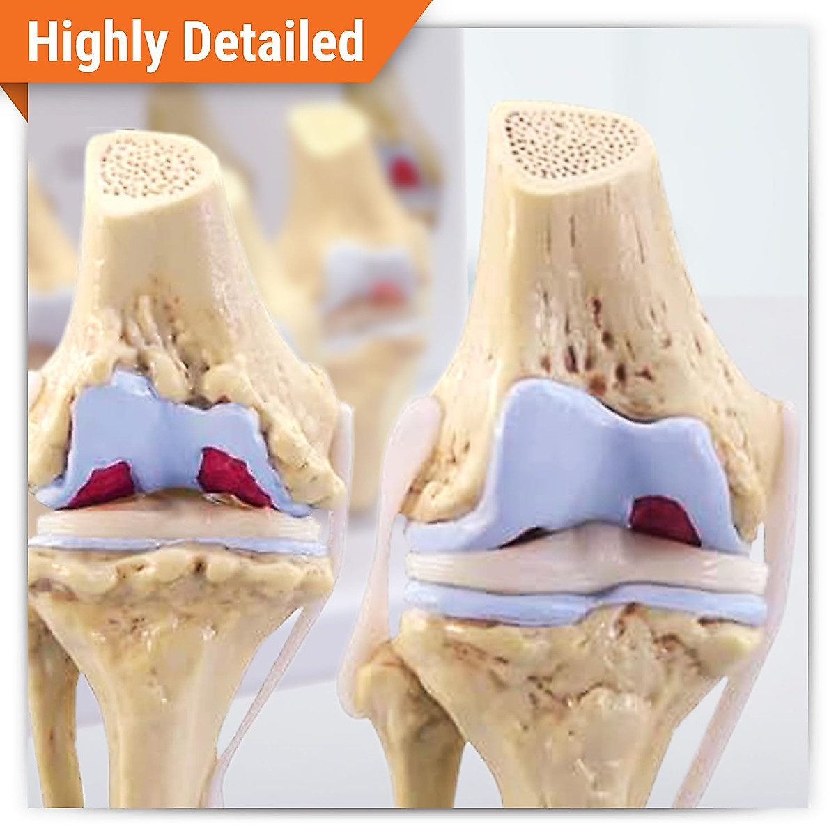 GPI Anatomicals Knee Joint Model Set | Human Body Anatomy Replica Set of 4-Stage Osteoarthritis Knee Joint for Doctors Office Educational Tool