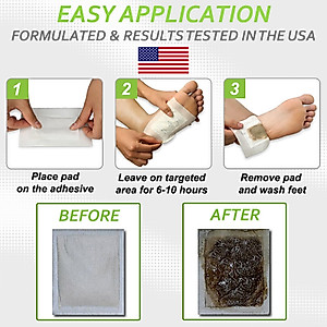 Dr. Entre's Foot Pads: Premium Foot Pads to Feel Better, Sleep Better & Relieve Stress | Effective Organic Lavender & Rose Foot Patches | 10 Pack