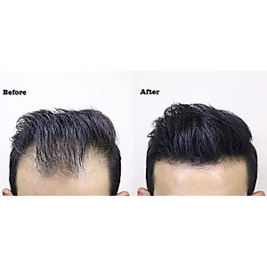 THICK FIBER Hair Fibers for Thinning Hair & Bald Spots (BLACK) - 25g Bottle - Conceals Hair Loss in Seconds - Hair Powder for Women & Men