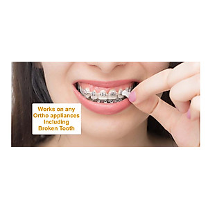 New Genuine Orthowax Plus - Now Precut with Aloe Vera and Vitamin E - Stick Better Than competitors - Orthodontic Wax for Braces Wearer (Pack of 9) - Unscented